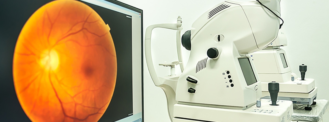 ¿Cómo se realiza una angiografía de retina?- canalSALUD