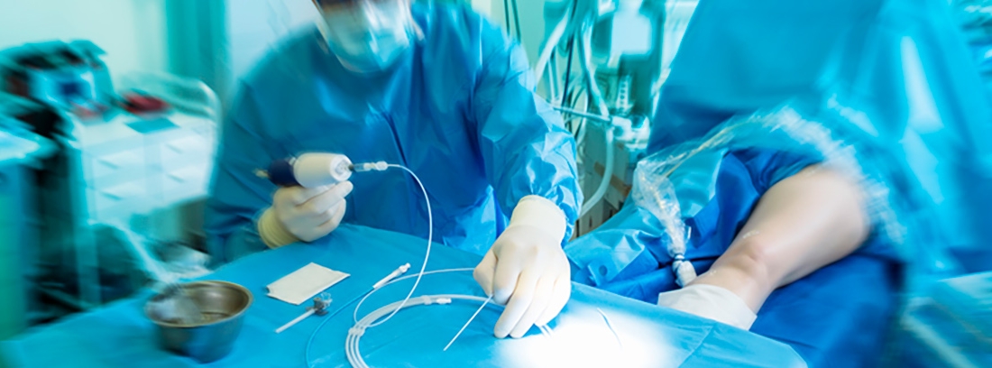 Cateterismo cardíaco: todo lo que debes saber- canalSALUD