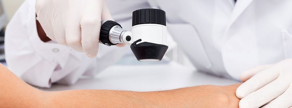 ¿Qué es una dermatoscopia y cómo se realiza? -canalSALUD