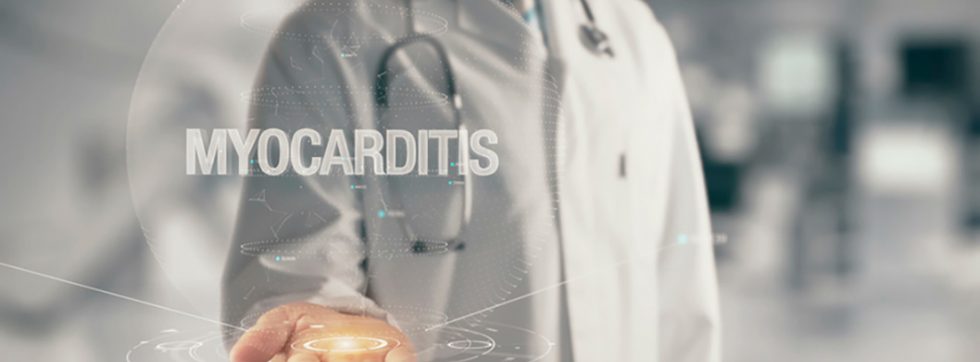 Miocarditis: qué es y síntomas principales-canalSALUD