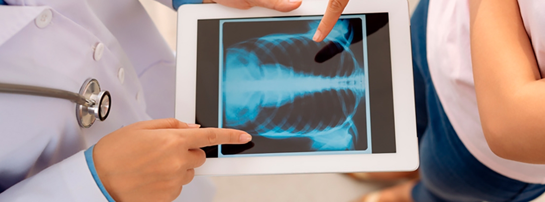 Radiografía - rayos X - pruebas diagnósticas - canalSALUD