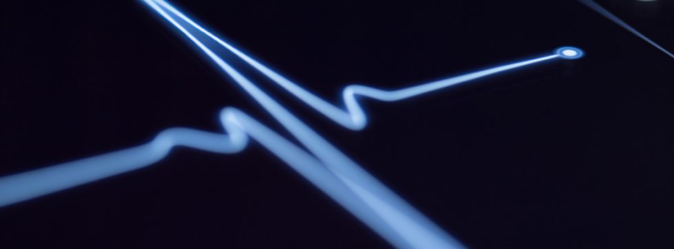 Síndrome de brugada: síntomas, diagnóstico y más - canalSALUD