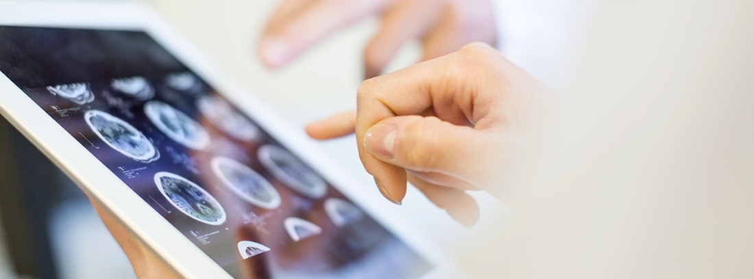 ¿Qué es el SPECT cerebral y para qué sirve? -canalSALUD