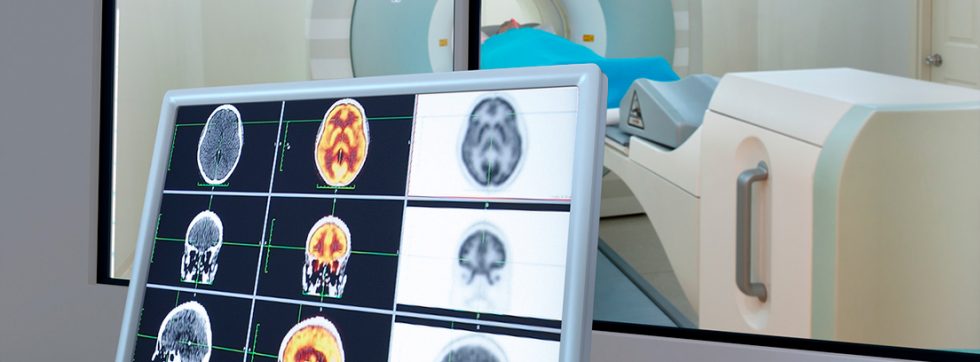 Angioresonancia magnética: qué es y cómo se realiza -canalSALUD