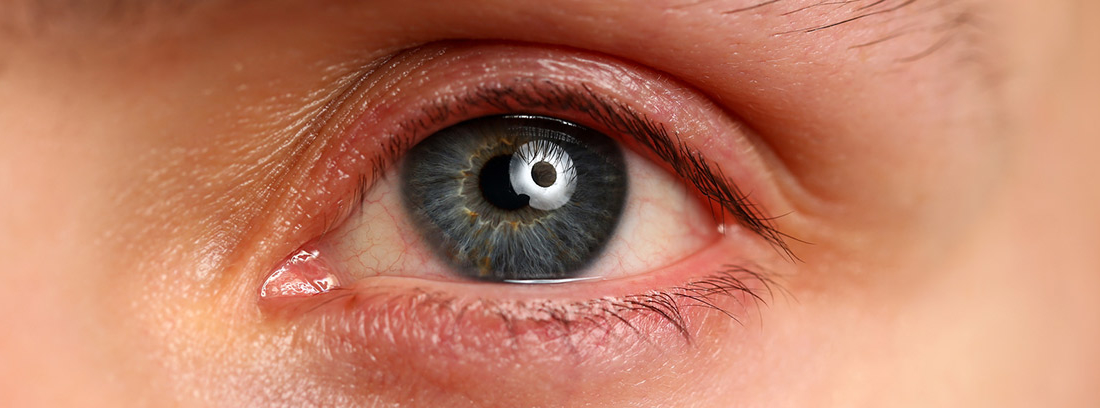 Celulitis Orbitaria: causas, síntomas y tratamiento -canalSALUD