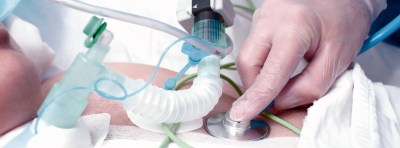 ¿Qué es una traqueotomía y su recuperación? – canalSALUD