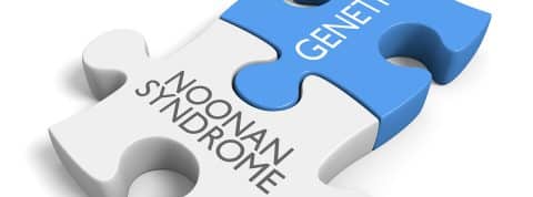 Síndrome de Noonan, causas y tratamiento -canalSALUD