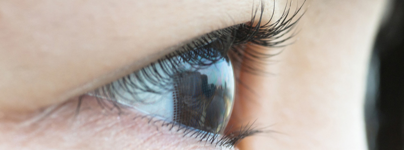 Síndrome de ojo de gato, diagnóstico y tratamiento -canalSALUD