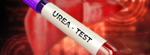 ¿Qué significa tener la Urea alta? Causas -Blogs MAPFRE
