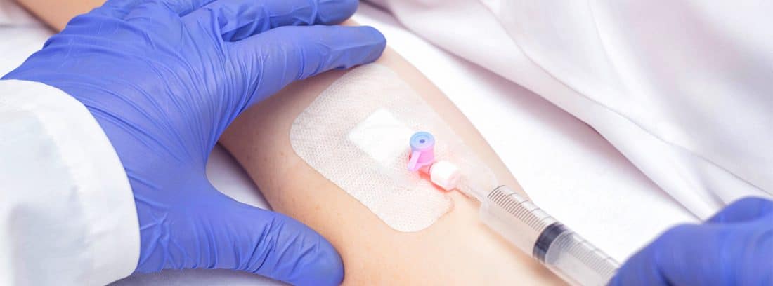 Ascitis: síntomas, causas y consecuencias- canalSALUD