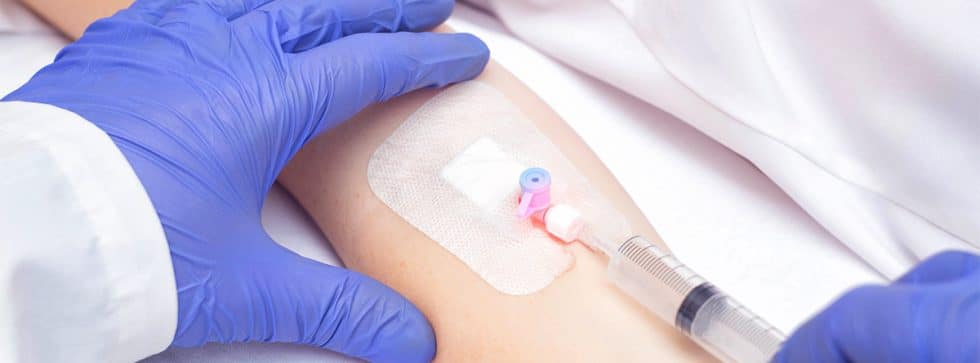 Ascitis: síntomas, causas y consecuencias- canalSALUD