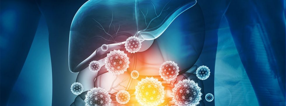 Ascitis: síntomas, causas y consecuencias- canalSALUD