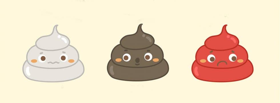 ¿Qué indica el color de las heces? -canalSALUD