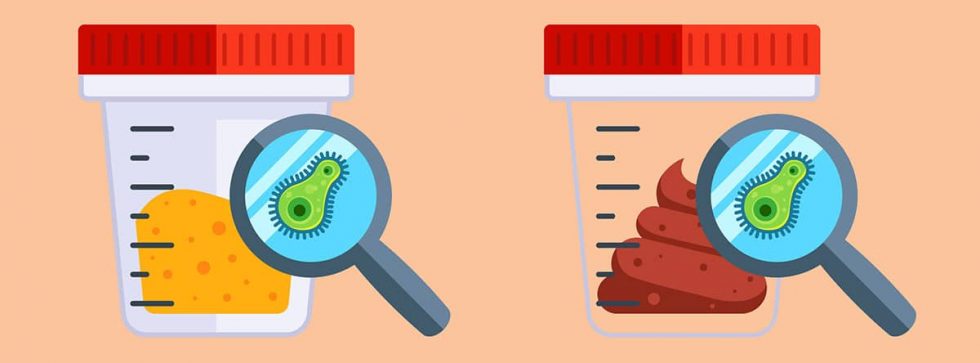 ¿Qué indica el color de las heces? -canalSALUD