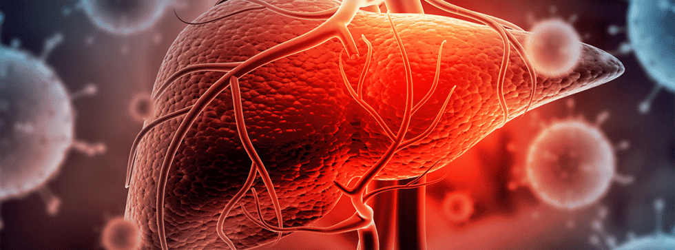 Paracentesis: ¿Cómo y cuándo se realiza? - canal Salud MAPFRE