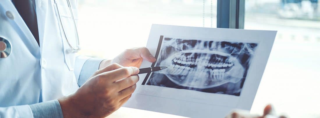Torus: prevención, síntomas y tratamiento- canalSALUD