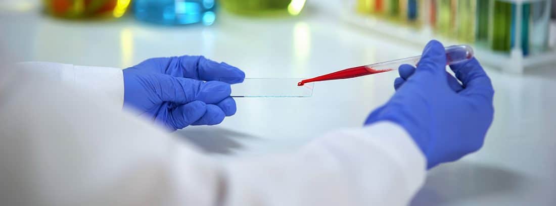 CHCM alta o baja, ¿qué significa? - Blogs MAPFRE