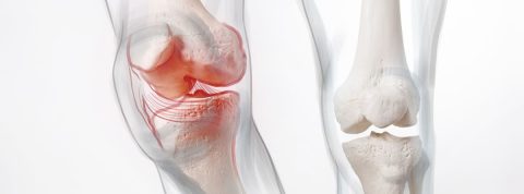 Síndrome de Reiter: todo lo que debes saber - Blogs MAPFRE