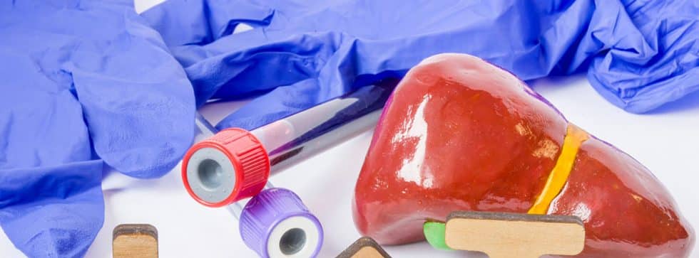 Prueba de gamma-glutamil transferasa (GGT) - Blogs MAPFRE