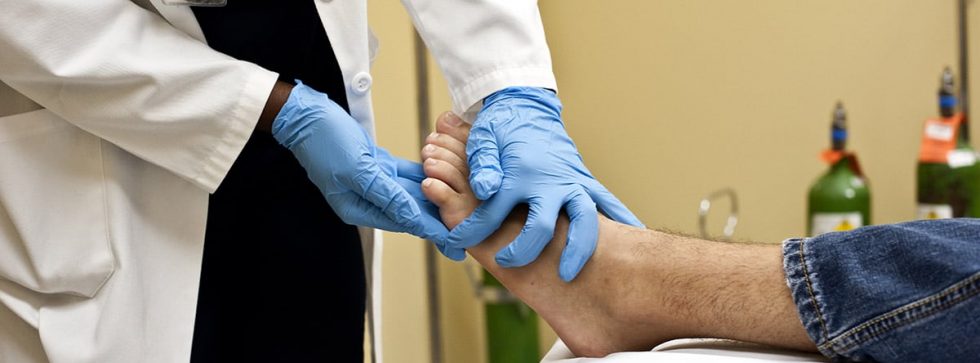 Dedo del pie roto: cuidados y tratamientos - Blogs MAPFRE