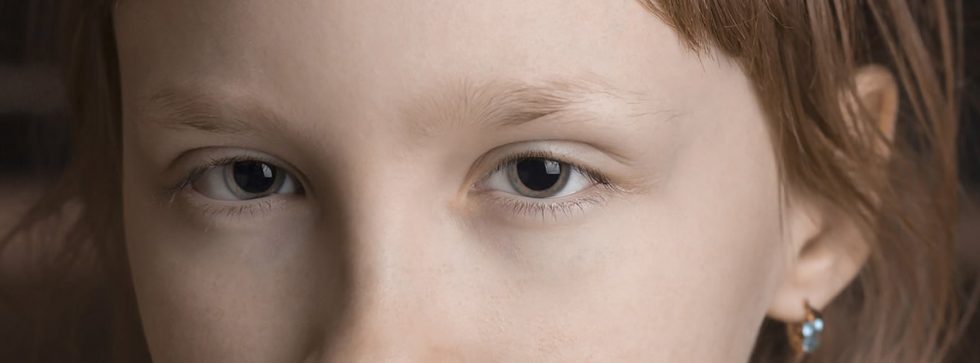 Midriasis: todo lo que debes saber - Blogs MAPFRE