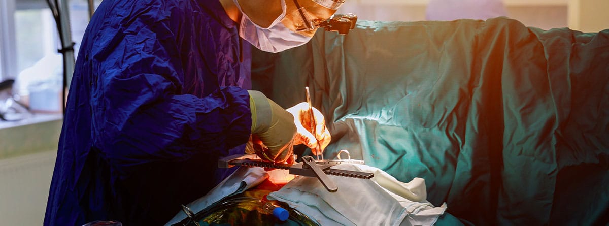 Operación a corazón abierto: cómo es y qué riesgos tiene – Blogs MAPFRE