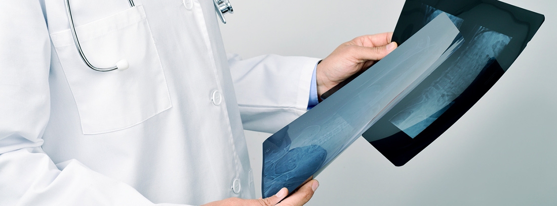 Enema opaco ¿Qué es y cómo se realiza? -canalSALUD