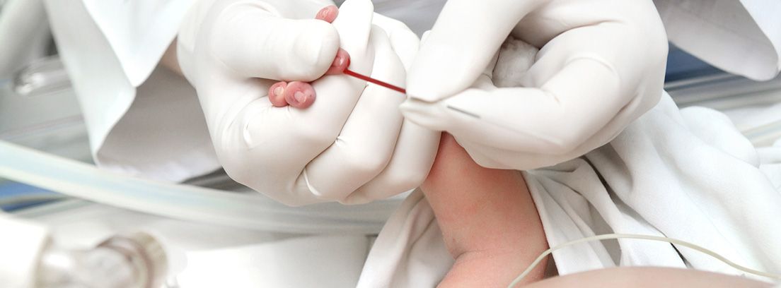 Causas del contagio del SIDA en niños -canalSALUD
