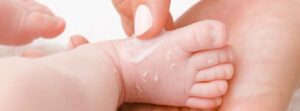 Melanosis pustulosa neonatal transitoria -canalSALUD