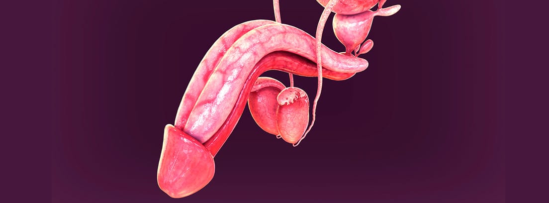 Parafimosis en el hombre, causas y tratamiento - canalSALUD