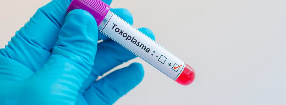 Toxoplasmosis: causas, tratamiento y prevensión -canalSALUD