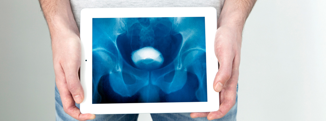 ¿Qué es una Urografía? - canalSALUD