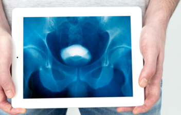 Urología: pruebas diagnósticas - canalSALUD