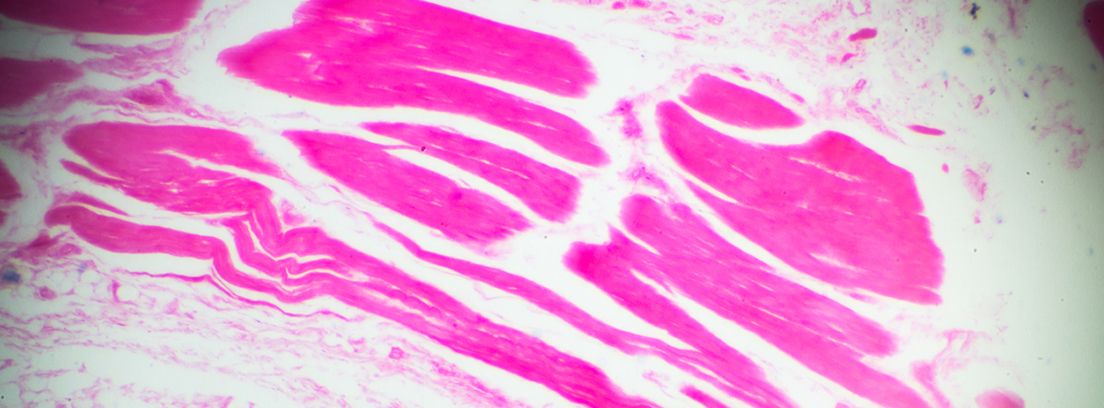 ¿Cómo se realiza una biopsia muscular? -canalSALUD