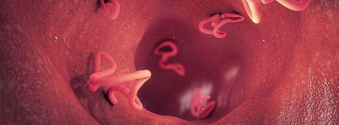 Tenia solitaria, teniasis: cómo se contagia - Blogs MAPFRE