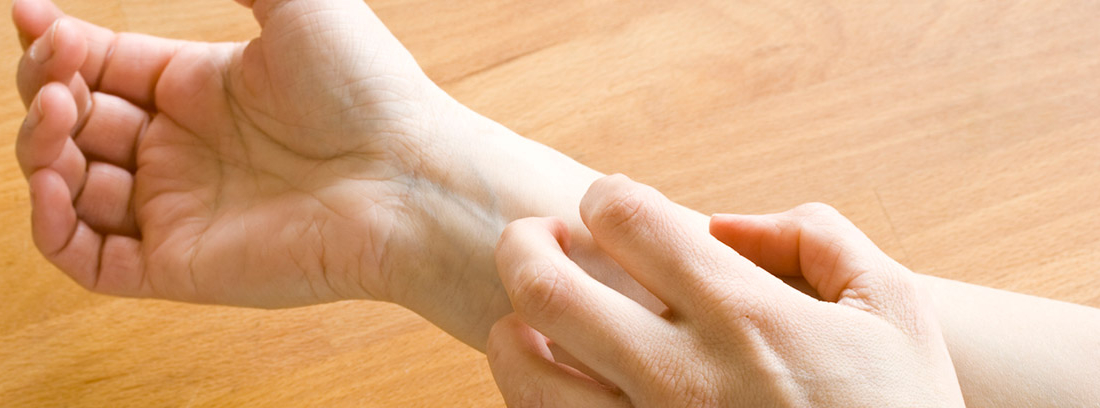 Dermografismo en la piel -canalSALUD