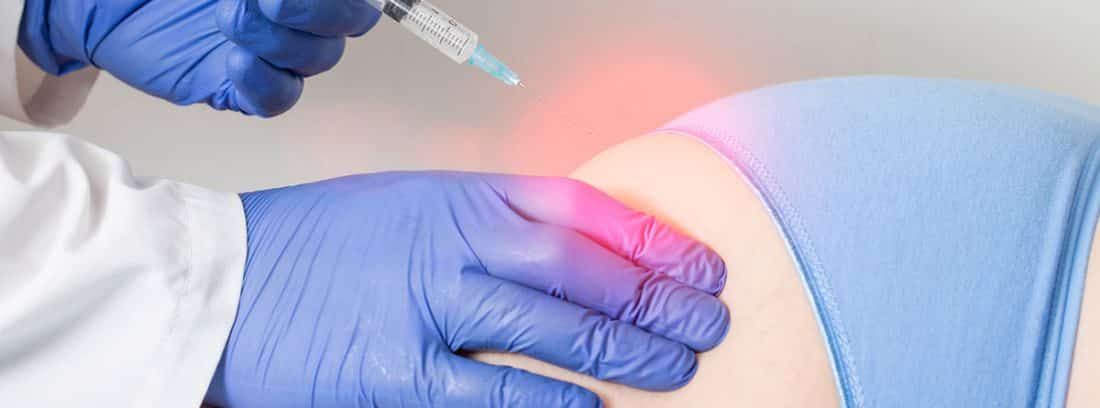 ¿Qué síntomas produce el síndrome piriforme? -canalSALUD