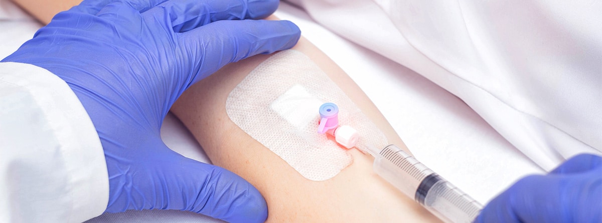 Ascitis: síntomas, causas y consecuencias- canalSALUD