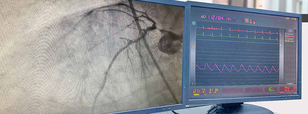 Fluoroscopia: cómo y para qué se hace -Blogs MAPFRE