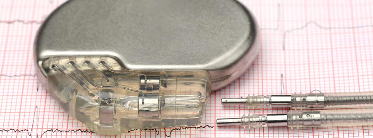 Qué es un marcapasos y para que sirve - Blogs MAPFRE